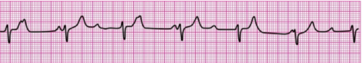 ACLS Post Test Answer Key 2023 Quizzma acls-post-test-answer-key-2023-quizzma