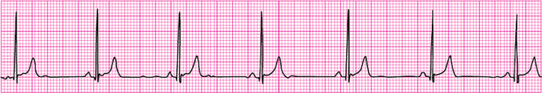ACLS Precourse Self Assessment Answers » ACLS Pre Test Answers