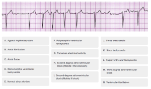 ACLS Precourse Self Assessment Answers » ACLS Pre Test Answers