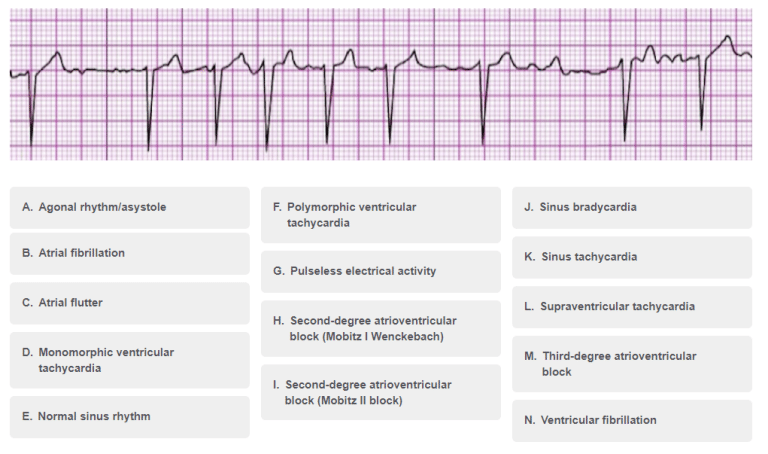 ACLS Precourse Self Assessment Answers » ACLS Pre Test Answers