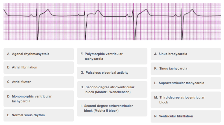 ACLS Precourse Self Assessment Answers » ACLS Pre Test Answers
