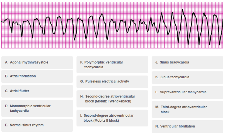 ACLS Precourse Self Assessment Answers » ACLS Pre Test Answers