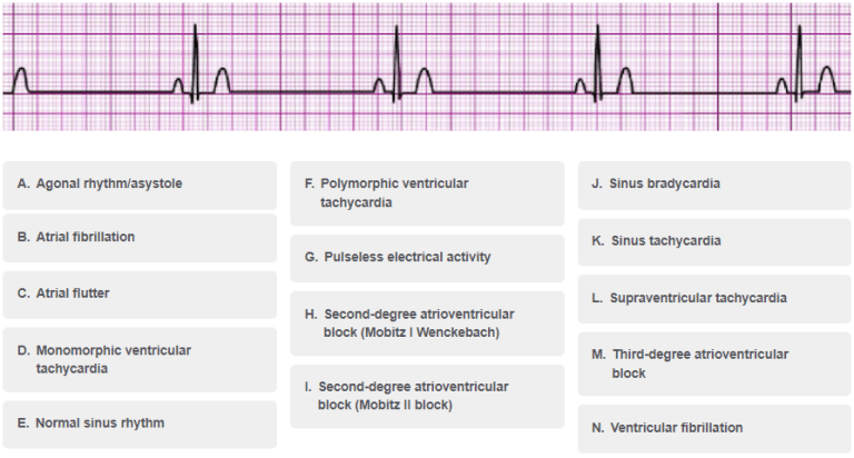 ACLS Precourse Self Assessment Answers » ACLS Pre Test Answers
