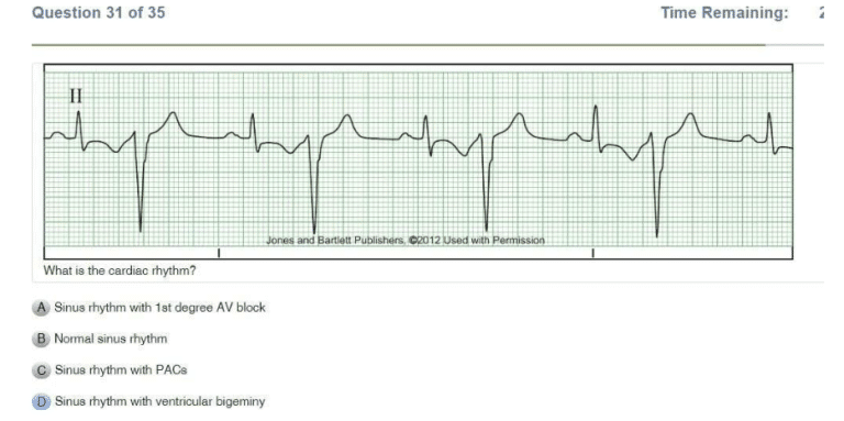 Relias Dysrhythmia Basic A Test Answers » Quizzma